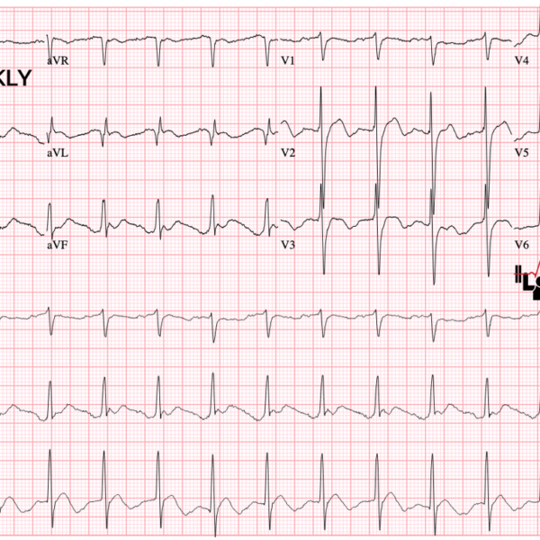 Weekly Workouts – ECG Weekly