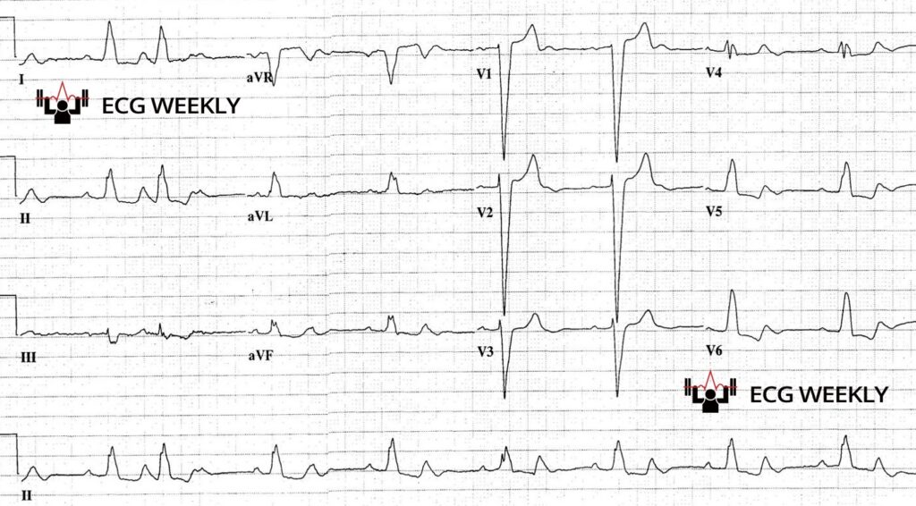 ECG Weekly Workouts – ECG Weekly