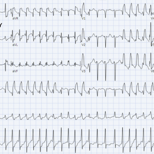 Weekly Workouts – ECG Weekly