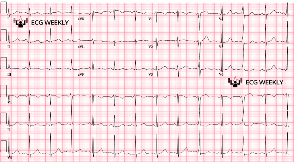 ECG Weekly Workouts – ECG Weekly