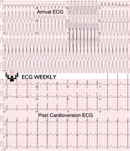 ECG Weekly Workouts – ECG Weekly