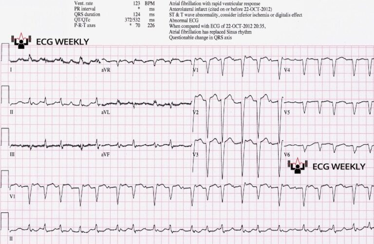ECG Weekly Workouts – ECG Weekly