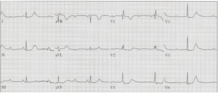 2024 ECG Competition Answers (Part 1/2) – ECG Weekly