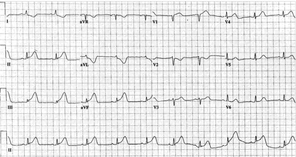 2024 ECG Competition Answers (Part 1/2) – ECG Weekly