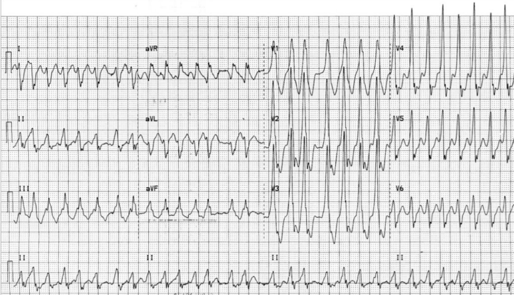 2024 ECG Competition Answers (Part 1/2) – ECG Weekly