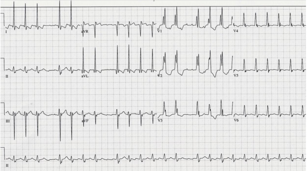 2024 ECG Competition Answers (Part 1/2) – ECG Weekly