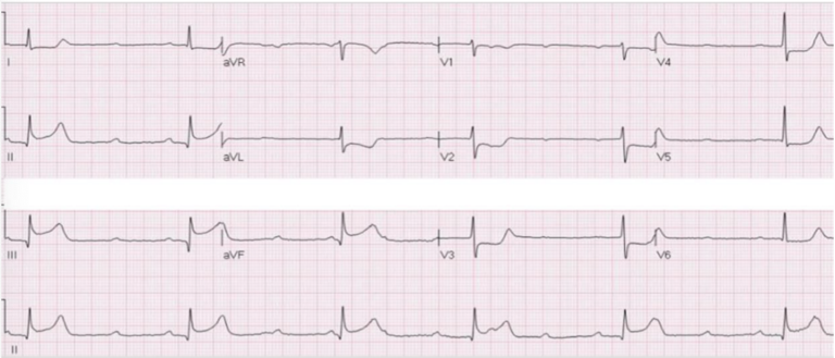 2024 ECG Competition Answers (Part 1/2) – ECG Weekly