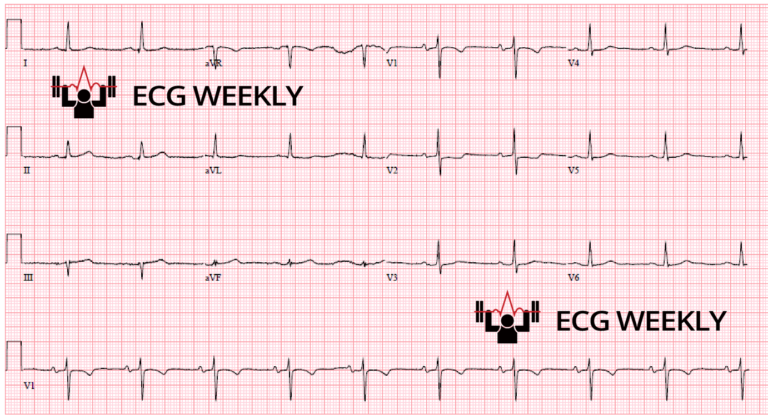 ECG Weekly Workouts – ECG Weekly