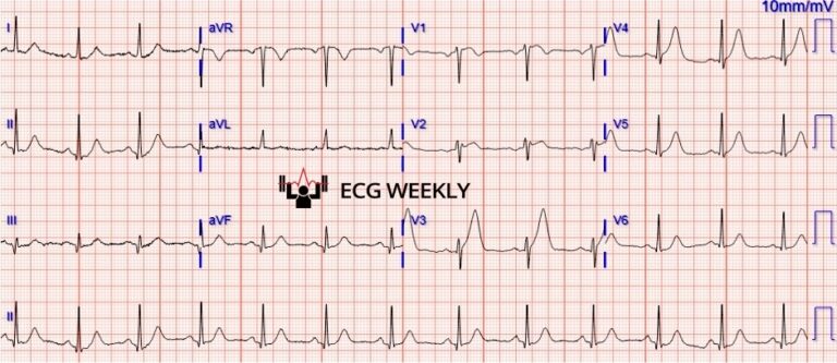 ECG Weekly Workouts – ECG Weekly