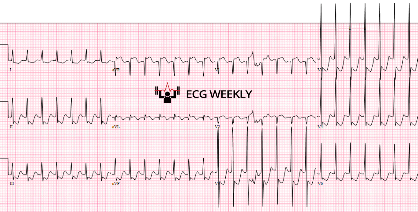 2025 EMS Cases Part I – ECG Weekly