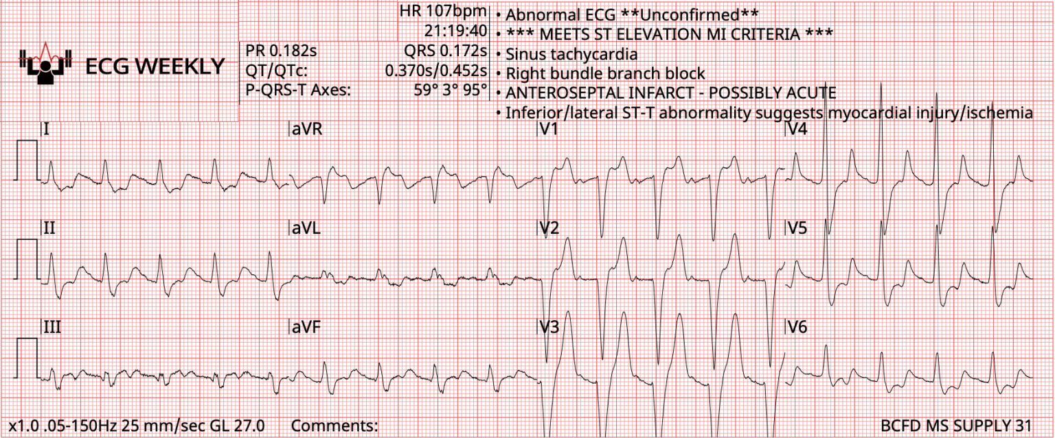 2025 EMS Cases Part II – ECG Weekly