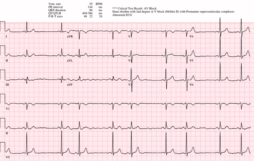Recent University of Maryland Medical Center Cases (Part I) – ECG Weekly
