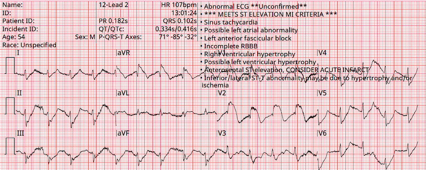 ECG Weekly – Mastering ECG Interpretation To Save And Improve More Lives